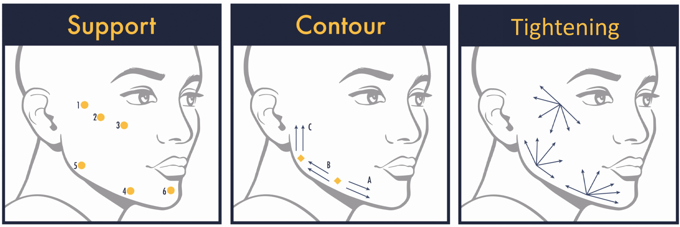 Injectables - Vida Health and Wellness